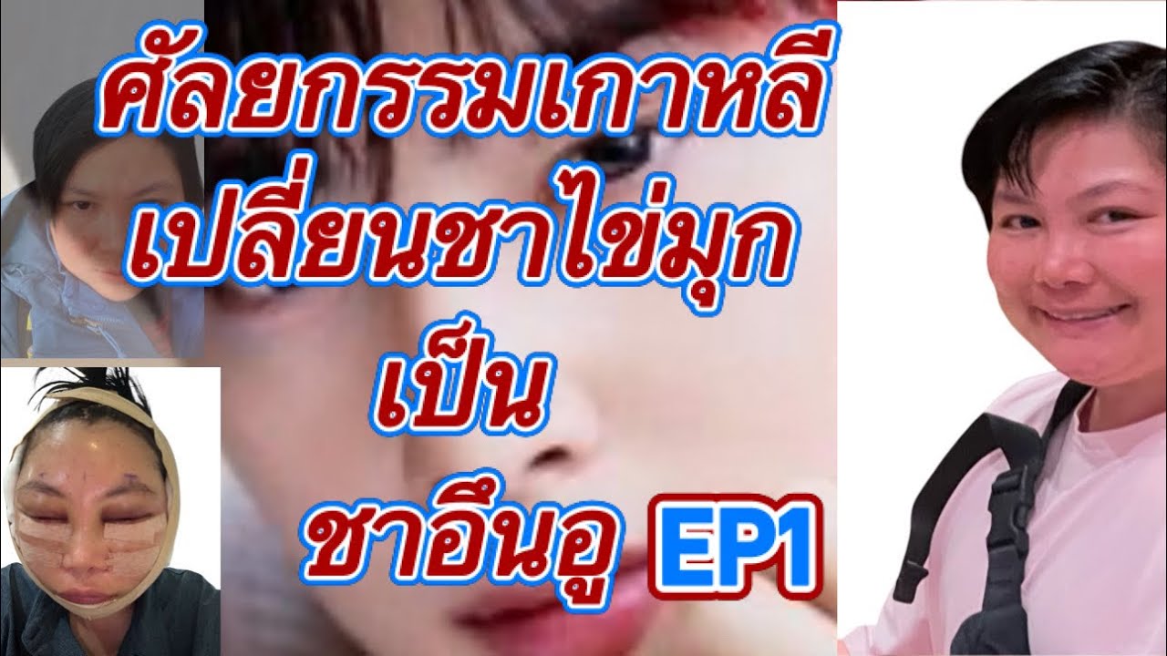 ศัลยกรรมเกาหลี โรงพยาบาลนานะ Cosmetic Surgery at Nana Hospital EP1 ...