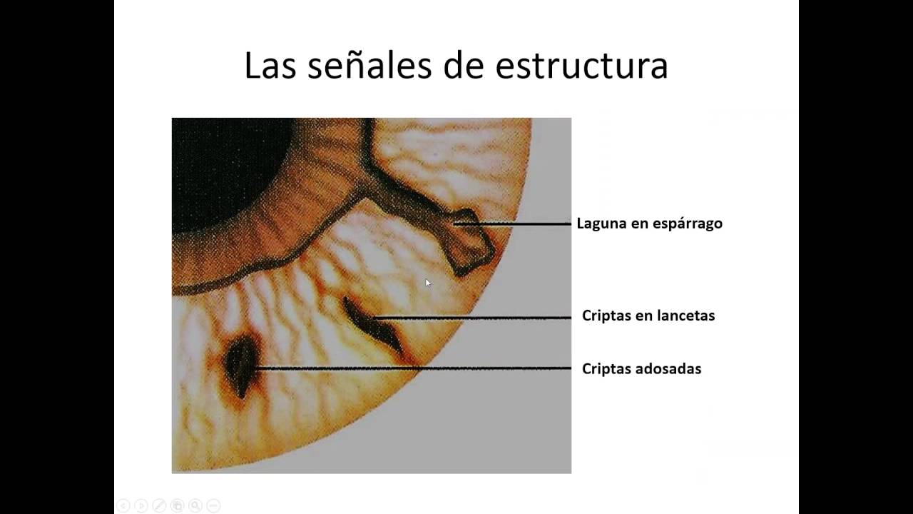 Signos Estructurales del Iris las Criptas y los Signos reflejos del ...