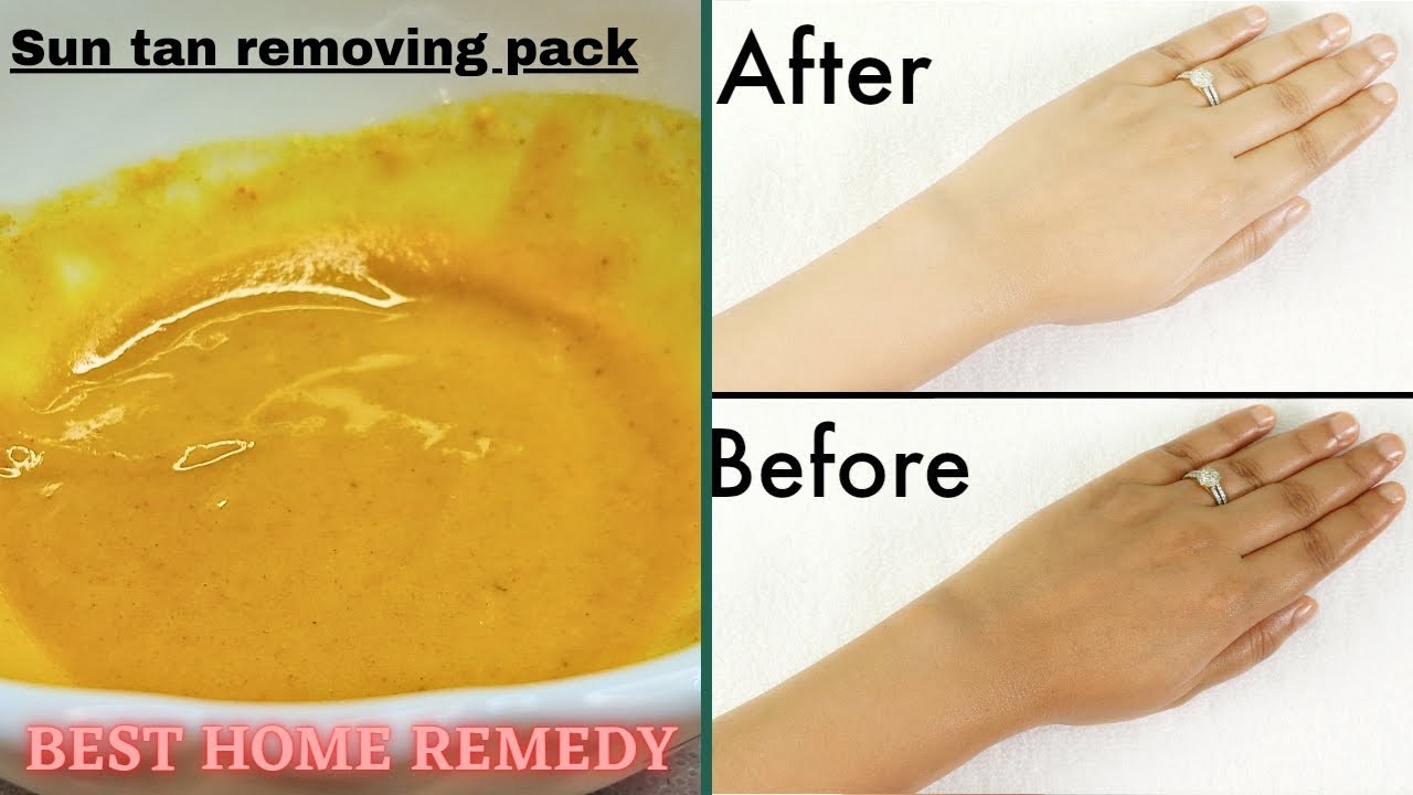 DIY De Tan Mask- Remove Suntan and Get Bright Skin Naturally . - YouTube