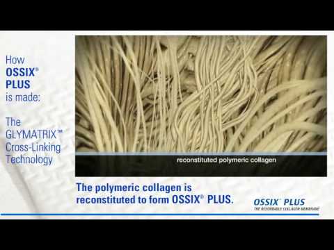 How Ossix Plus Is Made - YouTube