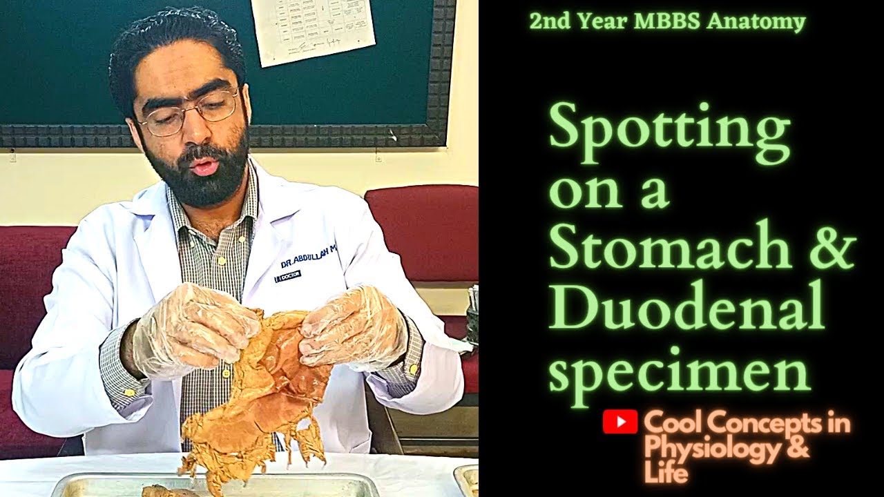Anatomy: Spotting on a Stomach & Duodenal specimen (2nd Year MBBS ...