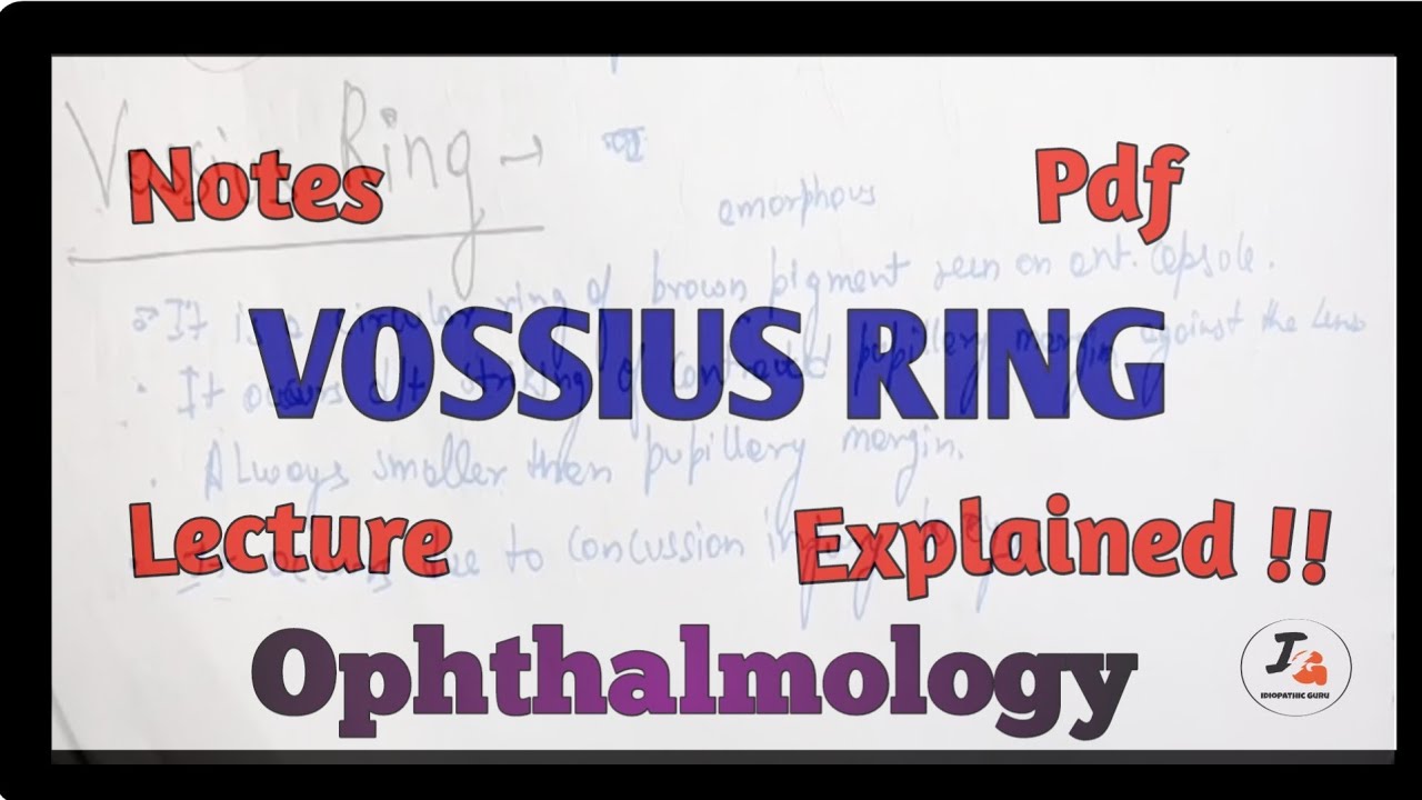Vossius Ring Ophthalmology - YouTube