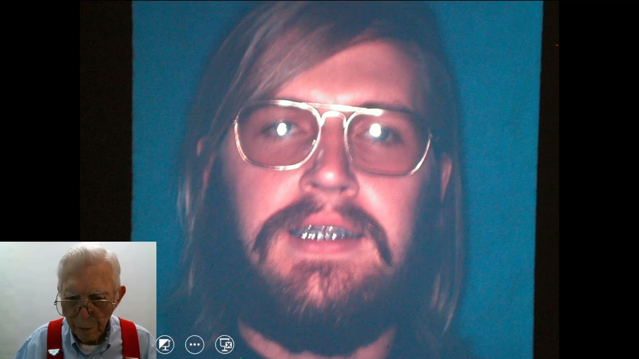 Obvious Wrongs - Treatment of a Deep Bite Case With TMJ Problem - YouTube