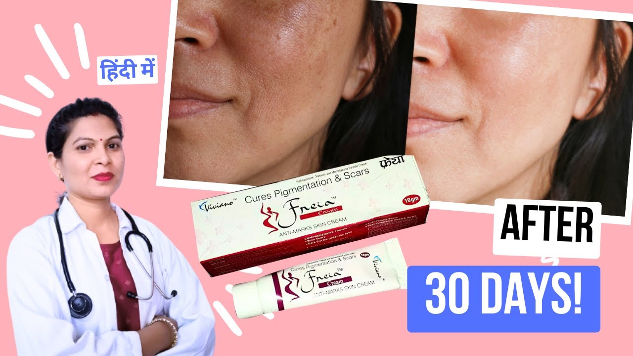 Freia Cream For Pigmentation & Scars Anti Marks Skin Cream Full Review ...