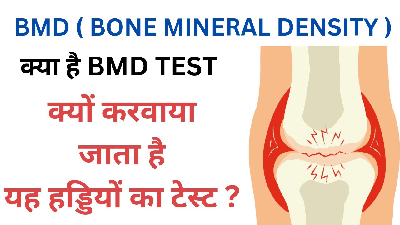 BMD-Bone Mineral Density Test क्यों करवाया जाता है ? - YouTube