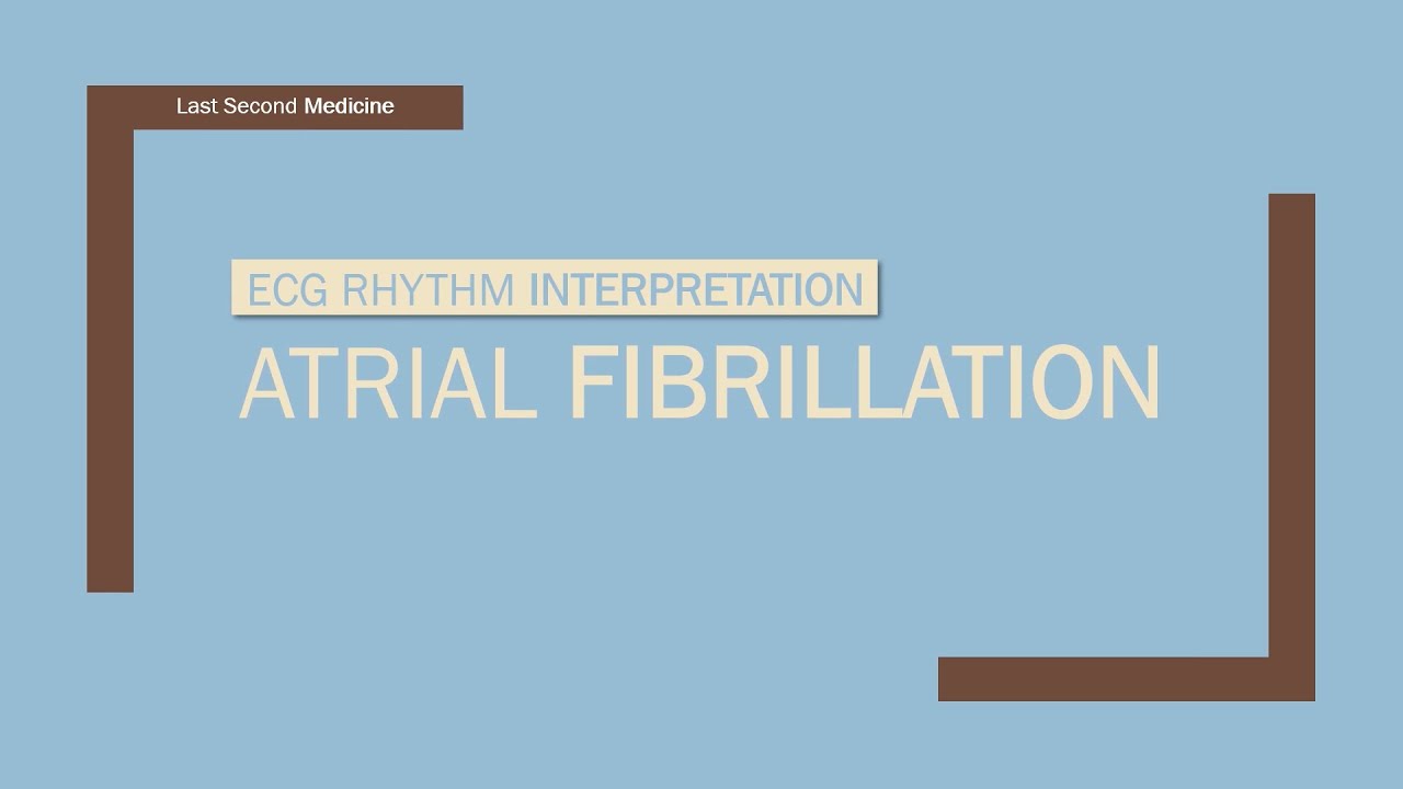 Atrial Fibrillation ECG Interpretation | ECG Rhythm Series - YouTube