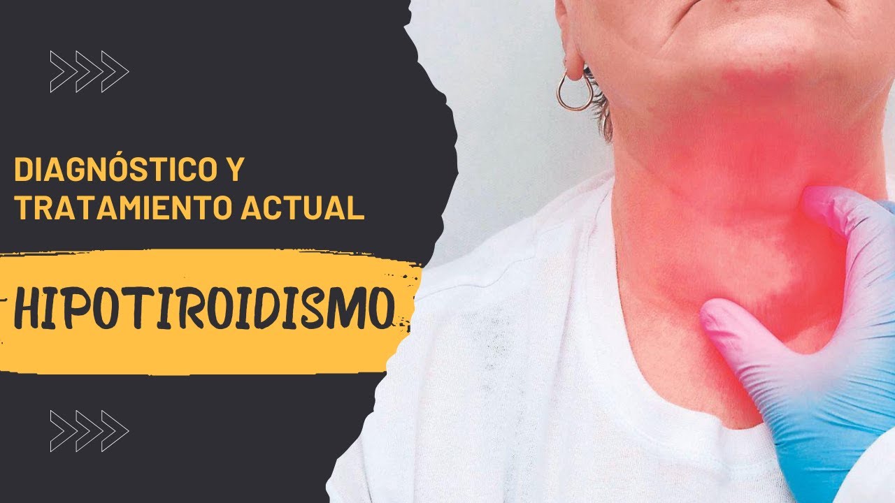¿Cómo diagnosticar y tratar el Hipotiroidismo Clínico y Subclinico ...