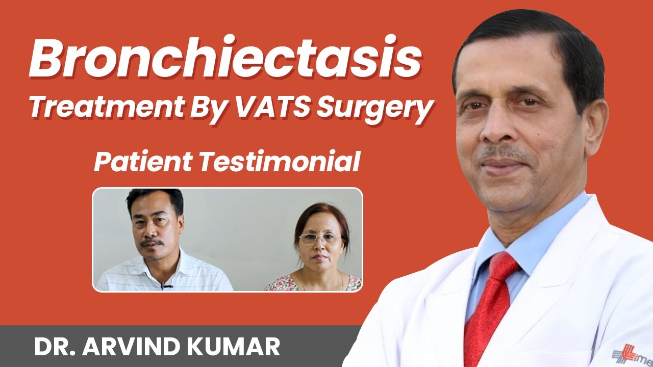 Bronchiectasis का सफल इलाज VATS (दूरबीन वाली सर्जरी) के द्वारा | Prof ...