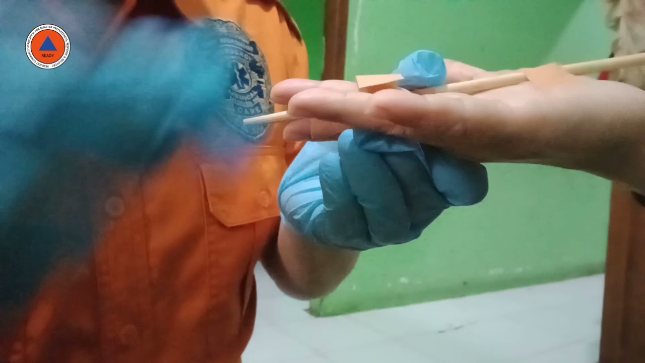 FA #8 Patah Tulang Jari - Pertolongan Pertama pada patah jari tangan ...