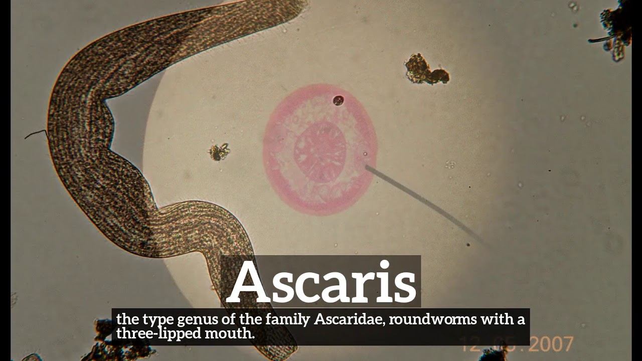 What is Ascaris? | How Does Ascaris Look? | How to Say Ascaris in ...