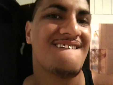 Samoan gold tooth after Pt.2 - YouTube
