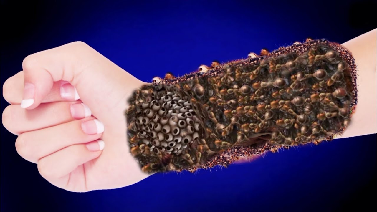 ASMR ANIMATION TREATMENT AND Trypophobia Deep Cleaning From infected ...