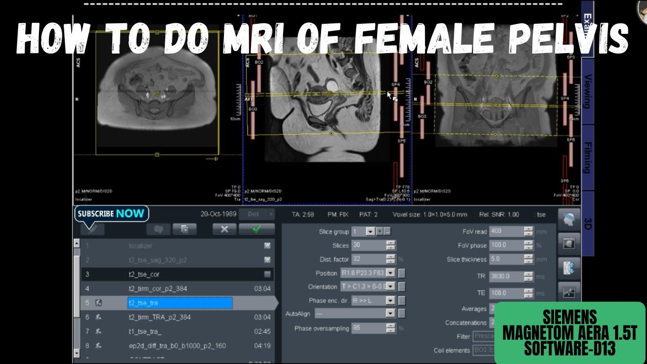 MRI of Female Pelvis Planning and Filming-Live Console Tutorial ...