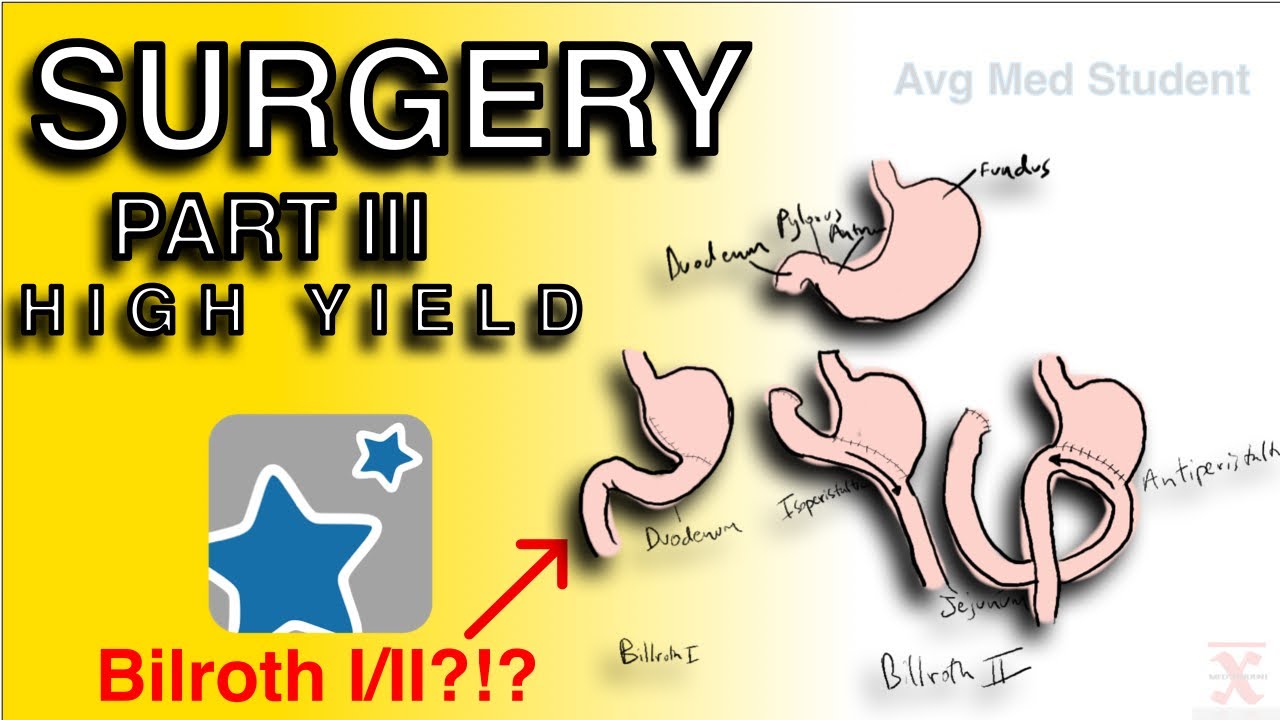 ANKI with me! SURGERY Part III HIGH YIELD USMLE STEP 2 / NBME SHELF ...