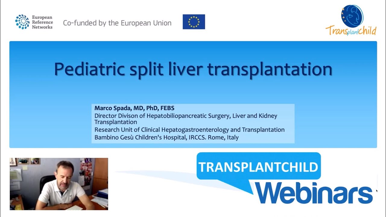 Paediatric Split Liver Transplantation - TransplantChild Webinars - YouTube
