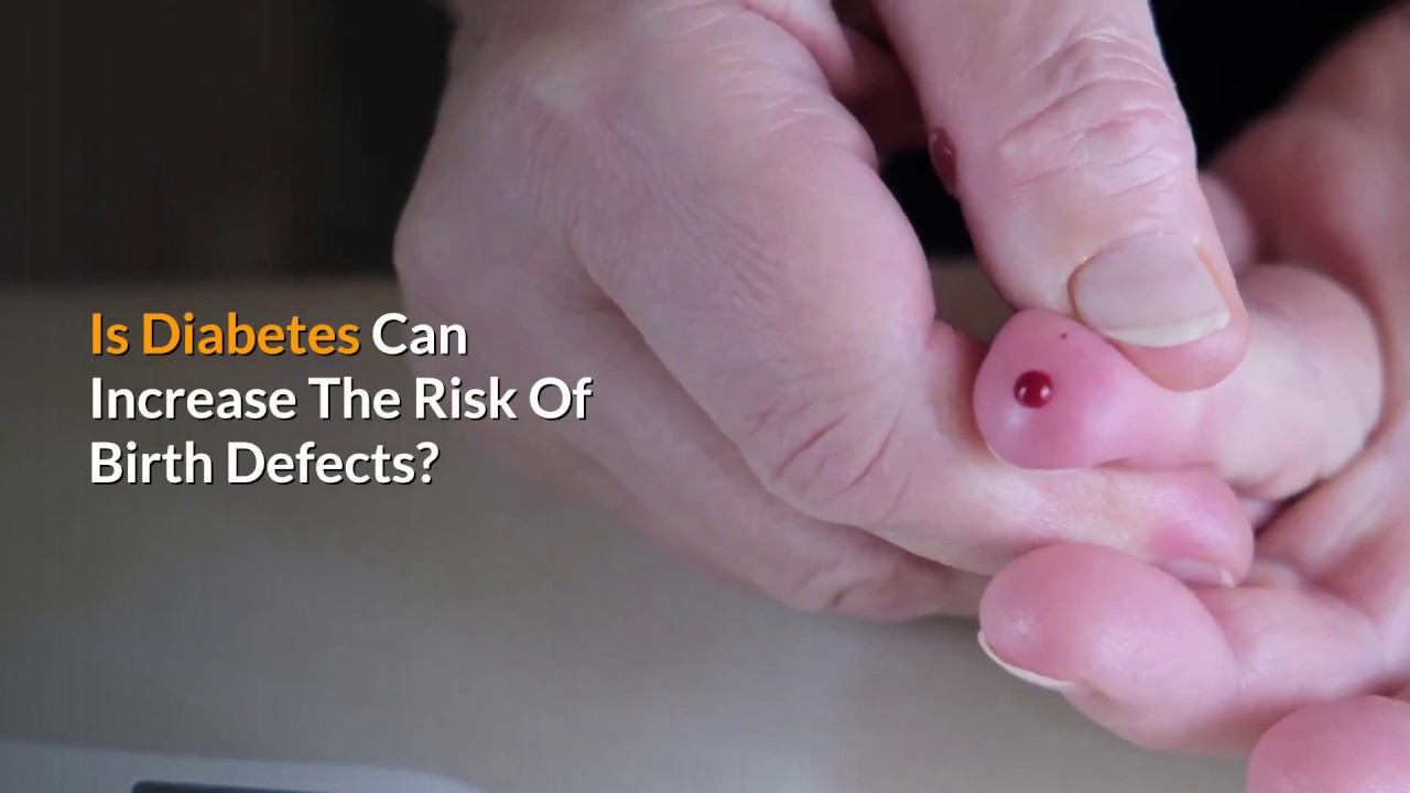 Is Diabetes Can Increase The Risk Of Birth Defects - YouTube