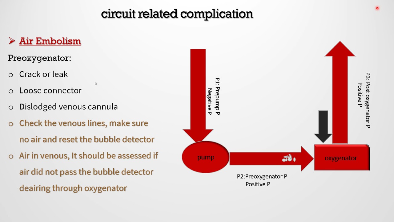 ecmo(extracorporeal memberane oxygenator) circuit part 5: mech comp(1 ...