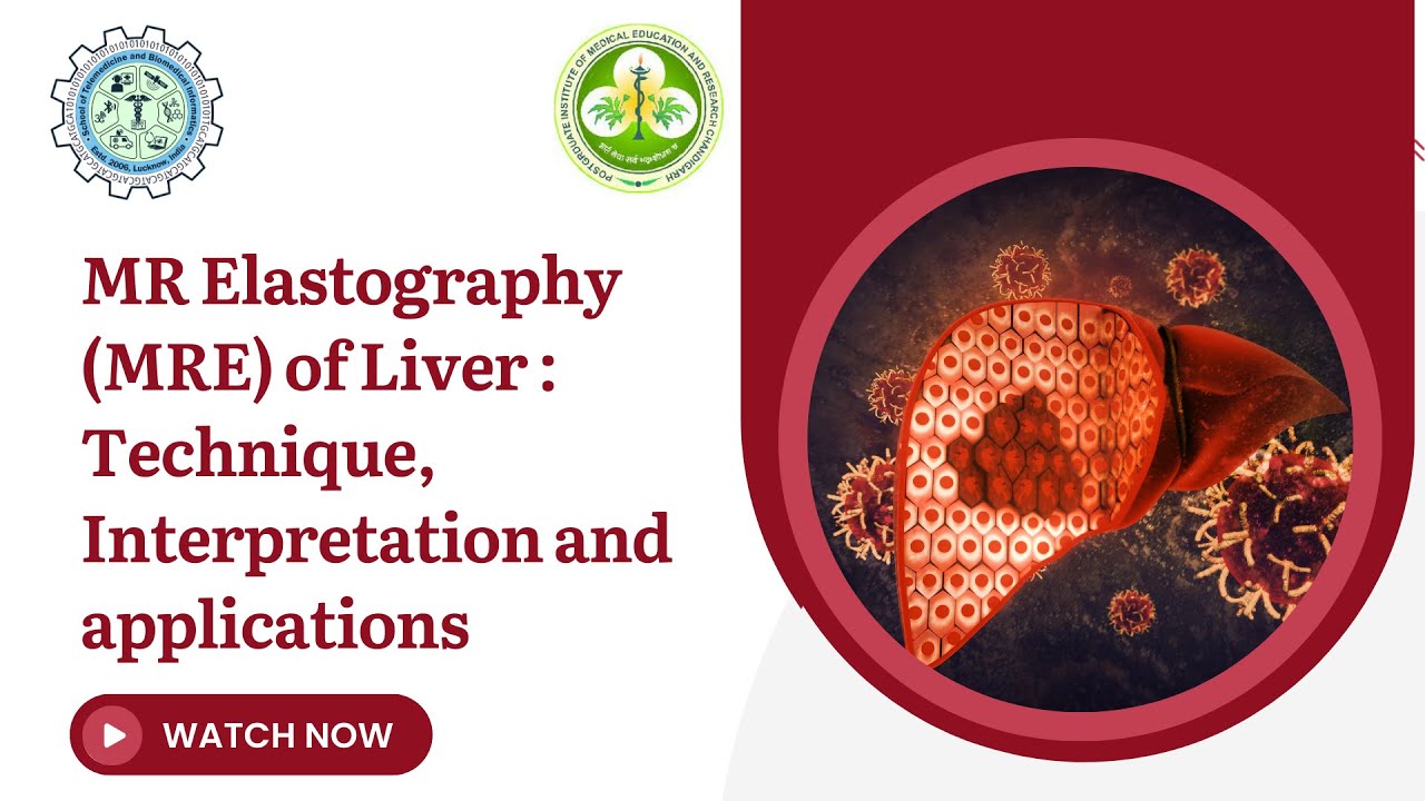 MR Elastography (MRE) of Liver : Technique, Interpretation and Applications - YouTube