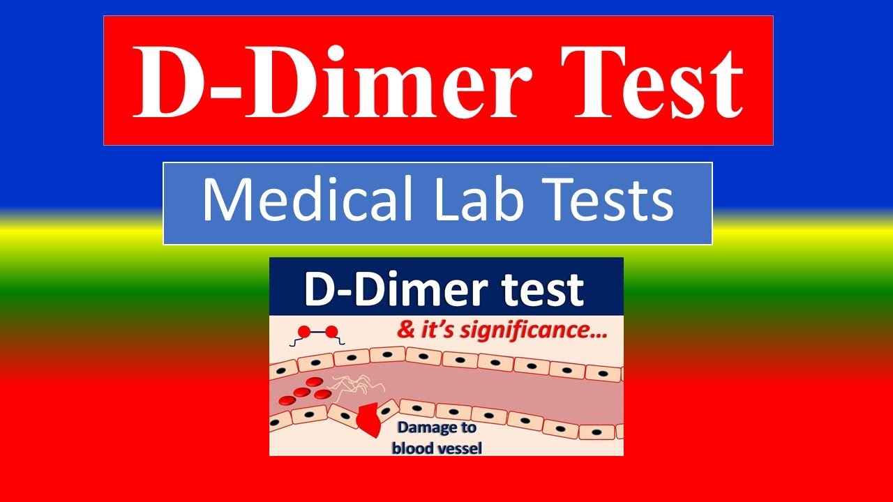 D- Dimer at test - what is? , Uses , Need , Risk , Preparation, Results ...