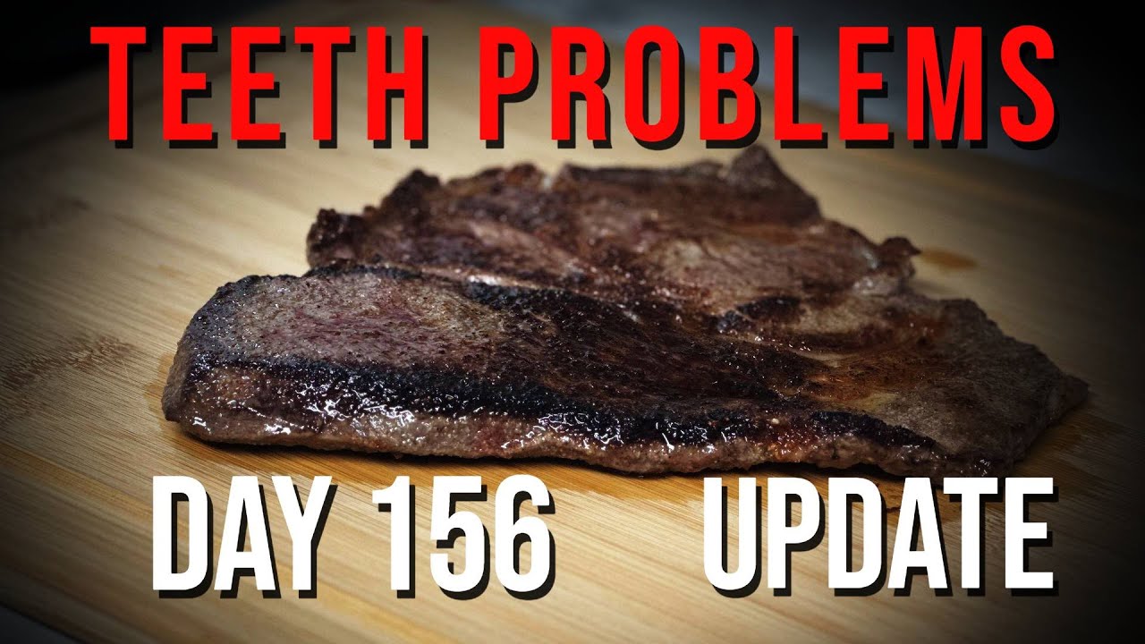 DAY 156 CARNIVORE (UPDATE) TEETH ISSUES AND EATING STEAK FAT...GROSS # ...
