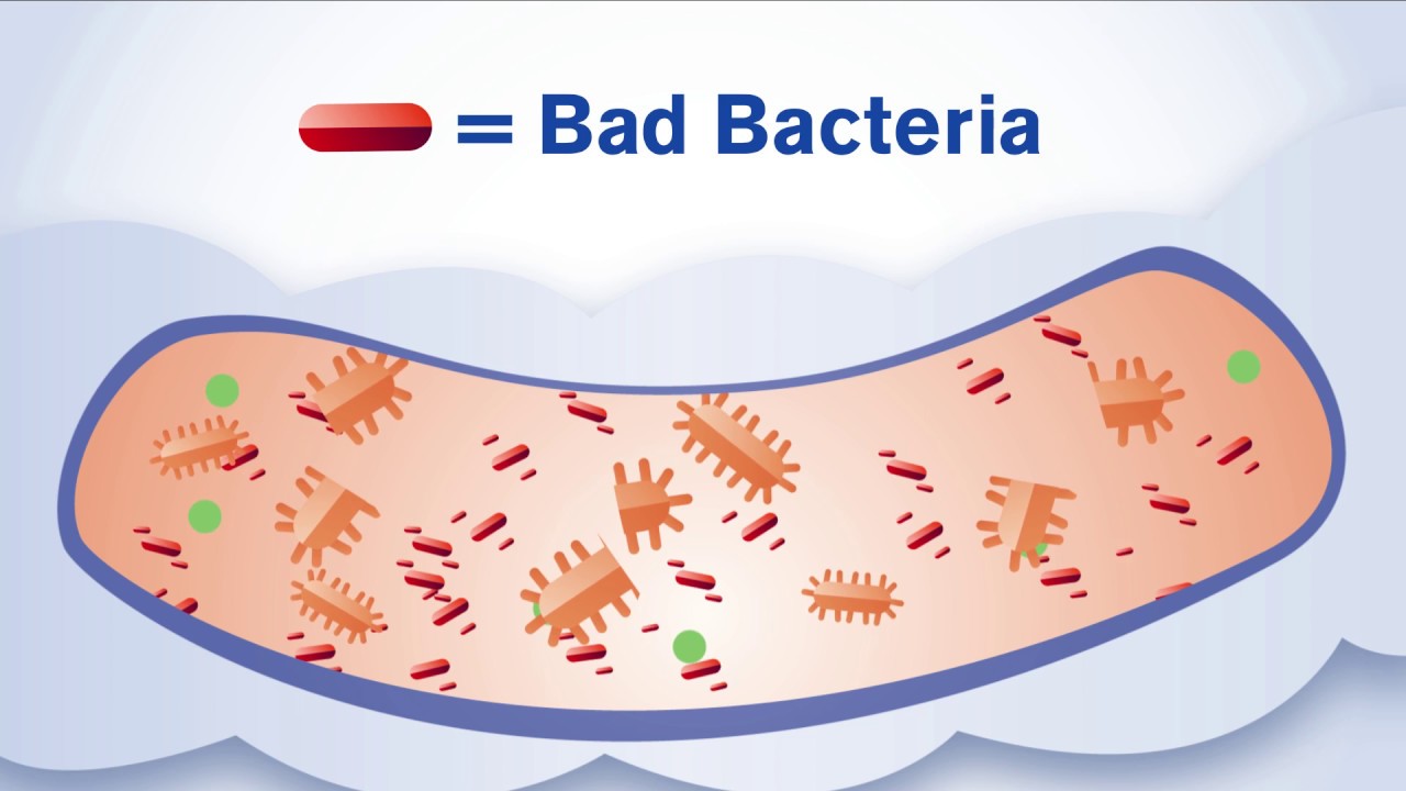 Beaumont researching way to stop C. difficile infections - YouTube