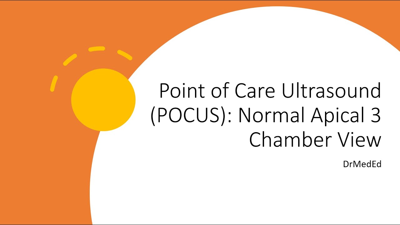 Point of Care Ultrasound (POCUS) - Normal Apical 3 Chamber View - YouTube