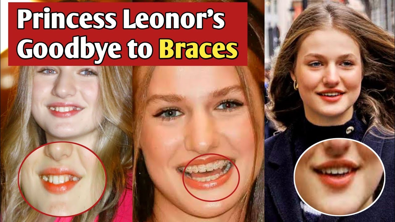 Princess Leonor Goodbye to Teeth Braces And Surprise with new Beautiful ...