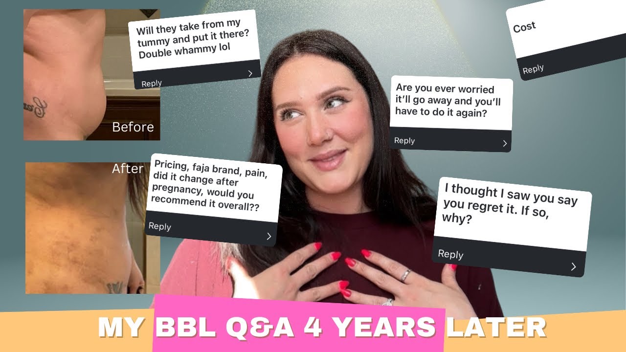My BBL experience- 4 years AFTER the procedure! - YouTube