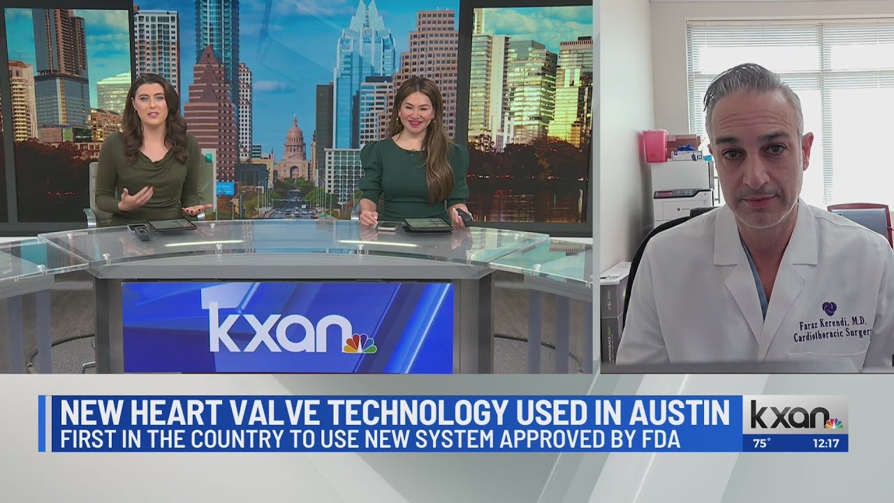New heart valve technology used in Texas - YouTube