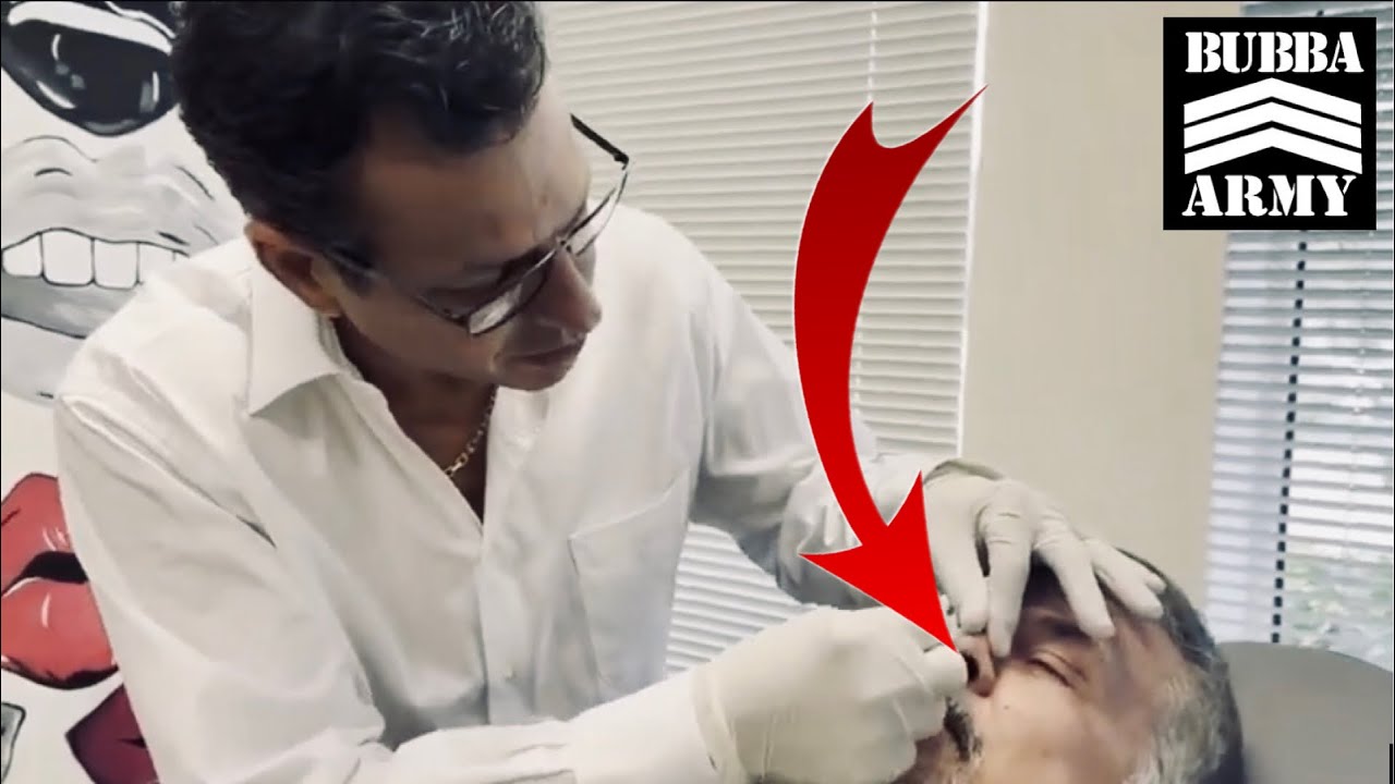Doctor Repairs a Split Nostril - #TheBubbaArmy - YouTube