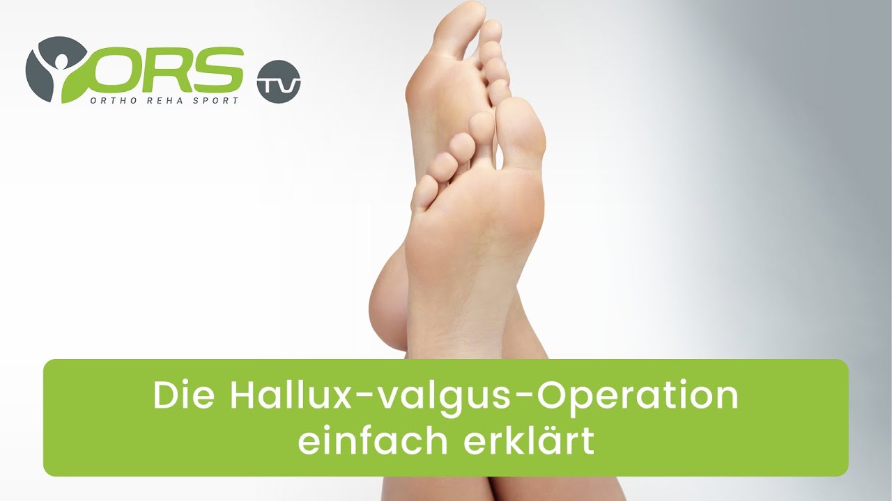 Die Hallux-valgus-Operation einfach erklärt - YouTube