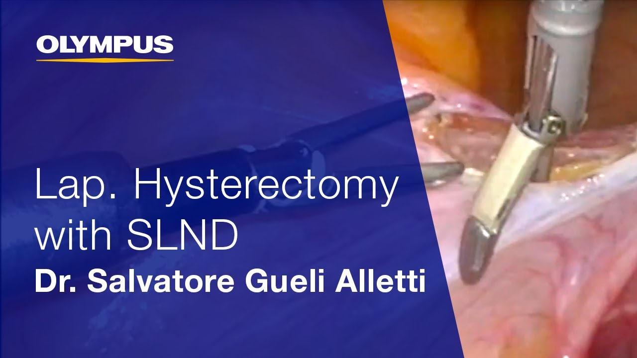Laparoscopic Hysterectomy with SLND | THUNDERBEAT | Dr. Salvatore Gueli ...