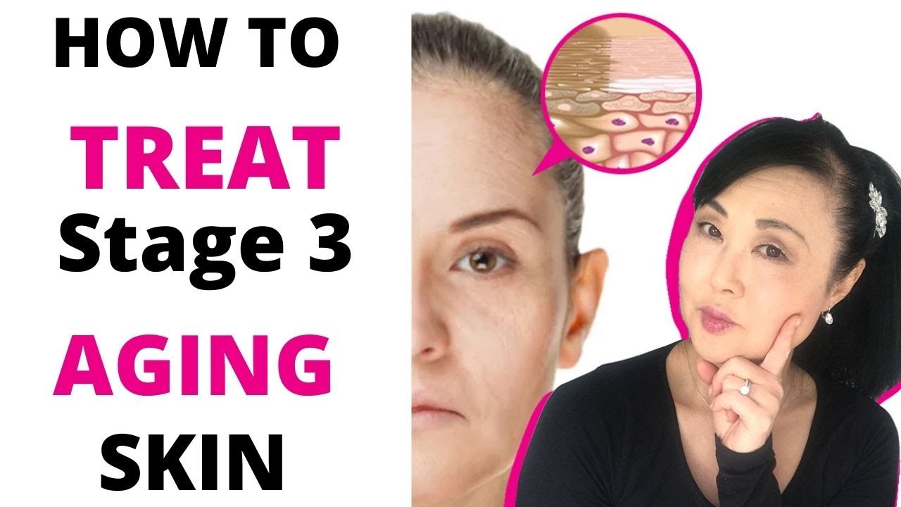 How To Treat Stage 3 Aging Skin - YouTube