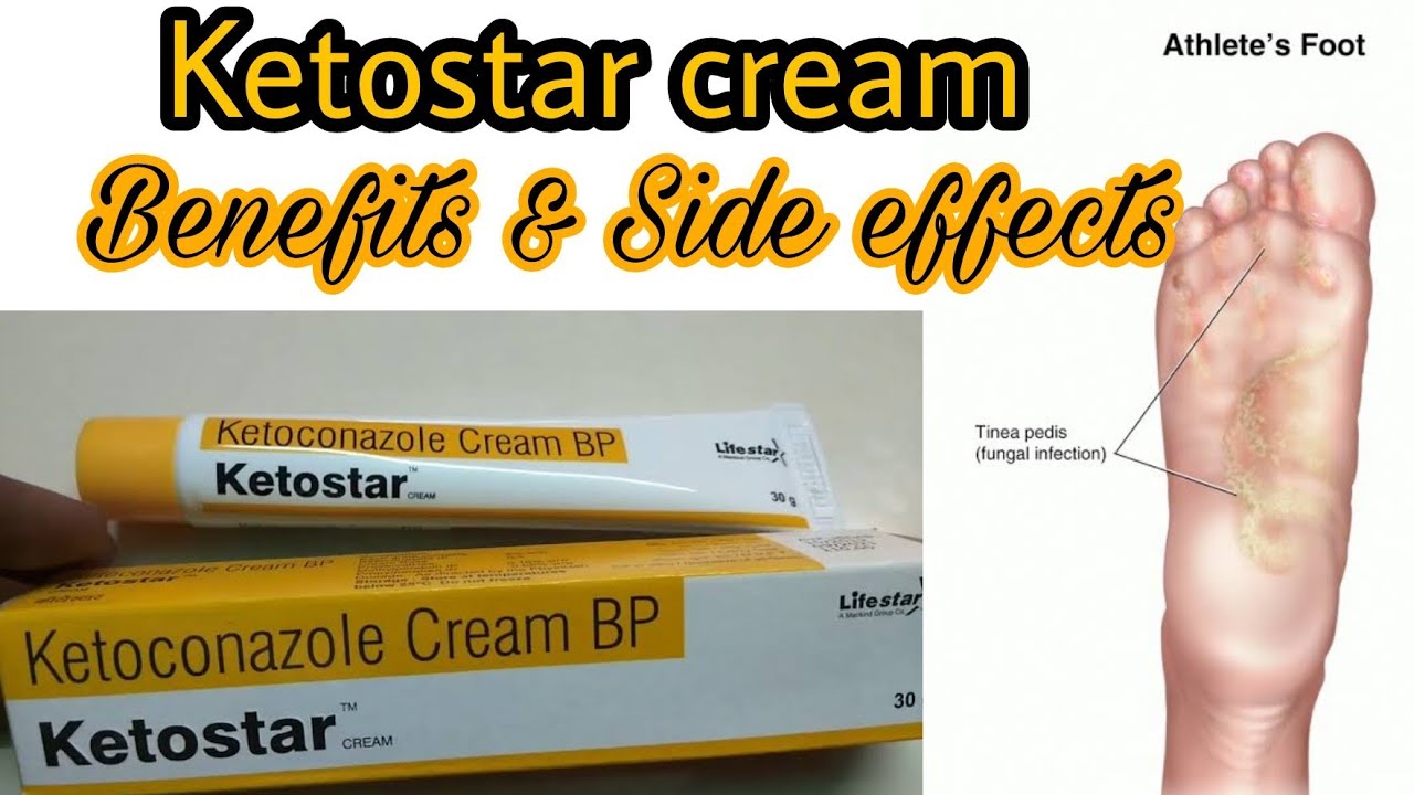 Ketostar ointment | ketaconazole ointment | athlets foot traetment ...