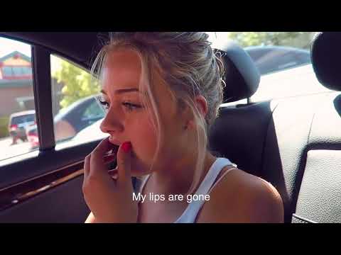 Girl Feels Loopy After Wisdom Teeth Surgery - 985483