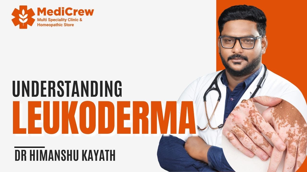 Understanding Leukoderma with Dr Himanshu Kayath | MediCrew Homoeopathy Clinic - YouTube