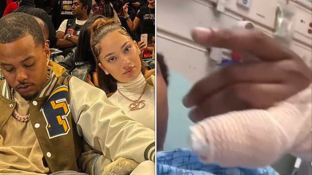 BHAD BARBIE BD LE VAUGHN GOES LIVE AFTER GETTING SHOT IN HAND & SHOWS WOUNDS - YouTube