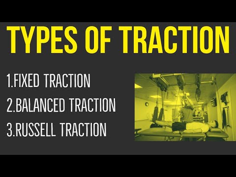 Types of Traction :Fixed,Balanced & Russell tractions. फिक्स्ड ...