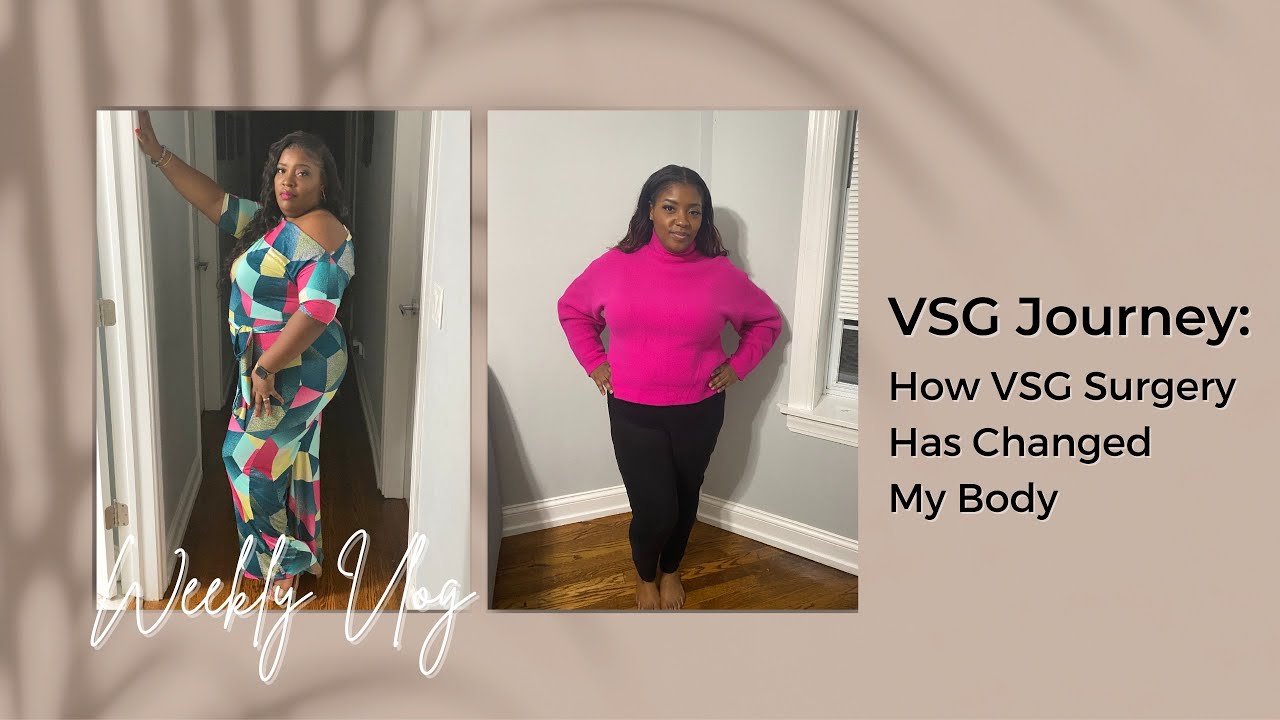 VSG Journey: How VSG Surgery Has Effected My Body - YouTube