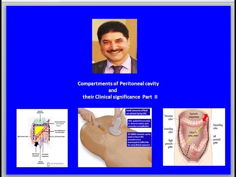 Compartments of peritoneal cavity and their Clinical significance part ...