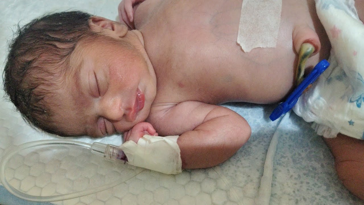 Newborn Premature Baby Boy Pritam | LSCS Delivery | 1 kg Birth Weight ...