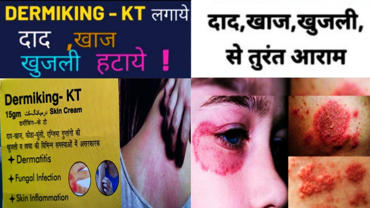 Dermiking kt skin cream || Use Of Dermiking KT Cream In Hindi || दाद ...