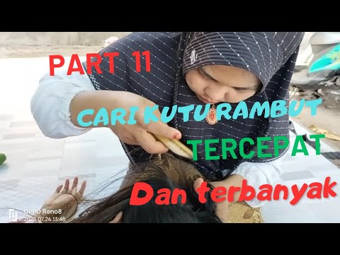 part 11 cari kutu rambut Tercepat dan terbanyak - YouTube