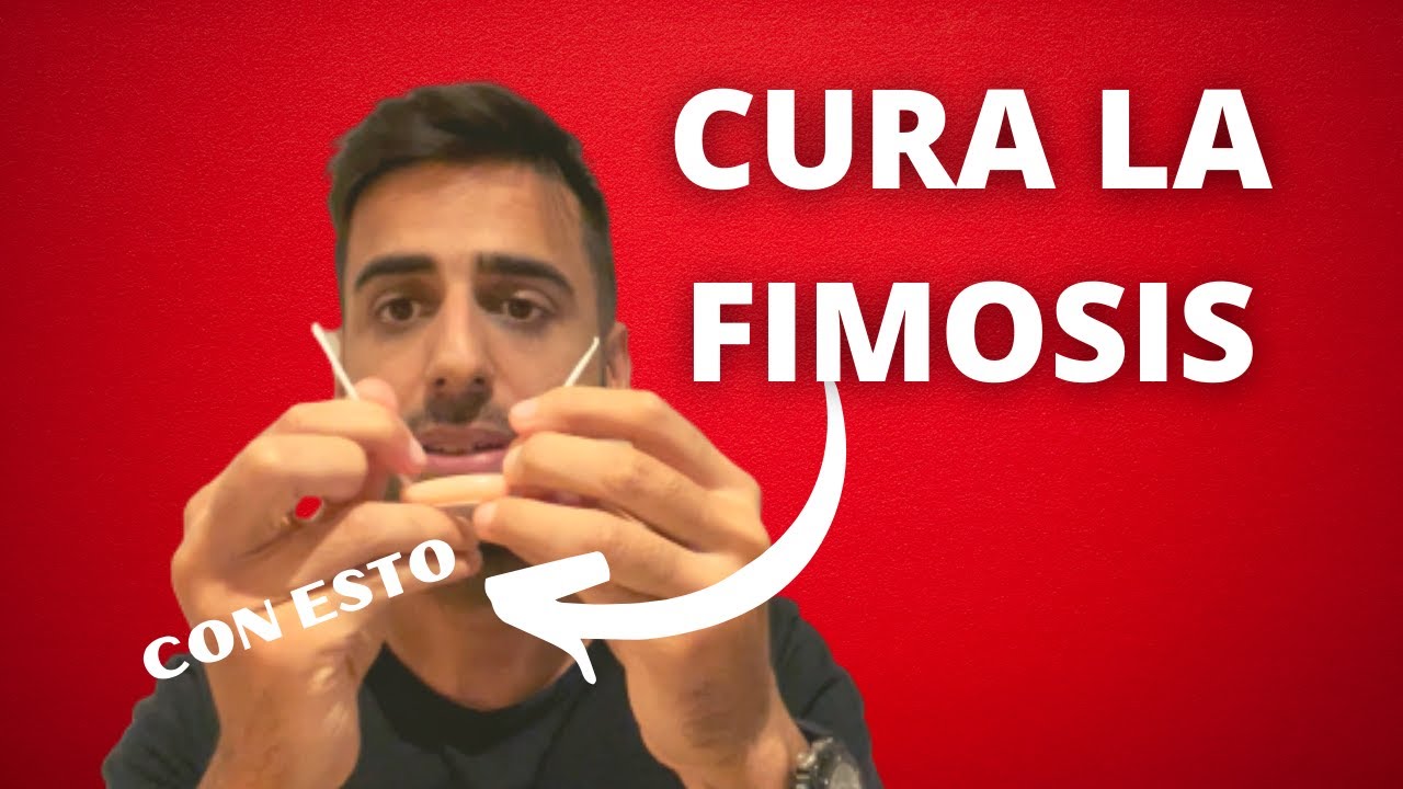 Tratamiento Casero y Natural Para Curar La Fimosis Sin Circuncisión ...