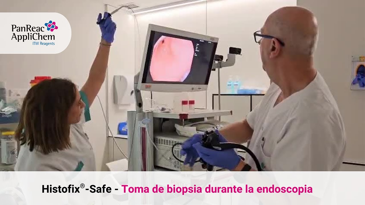 Histofix®-Safe: Toma de biopsia durante la endoscopia - YouTube