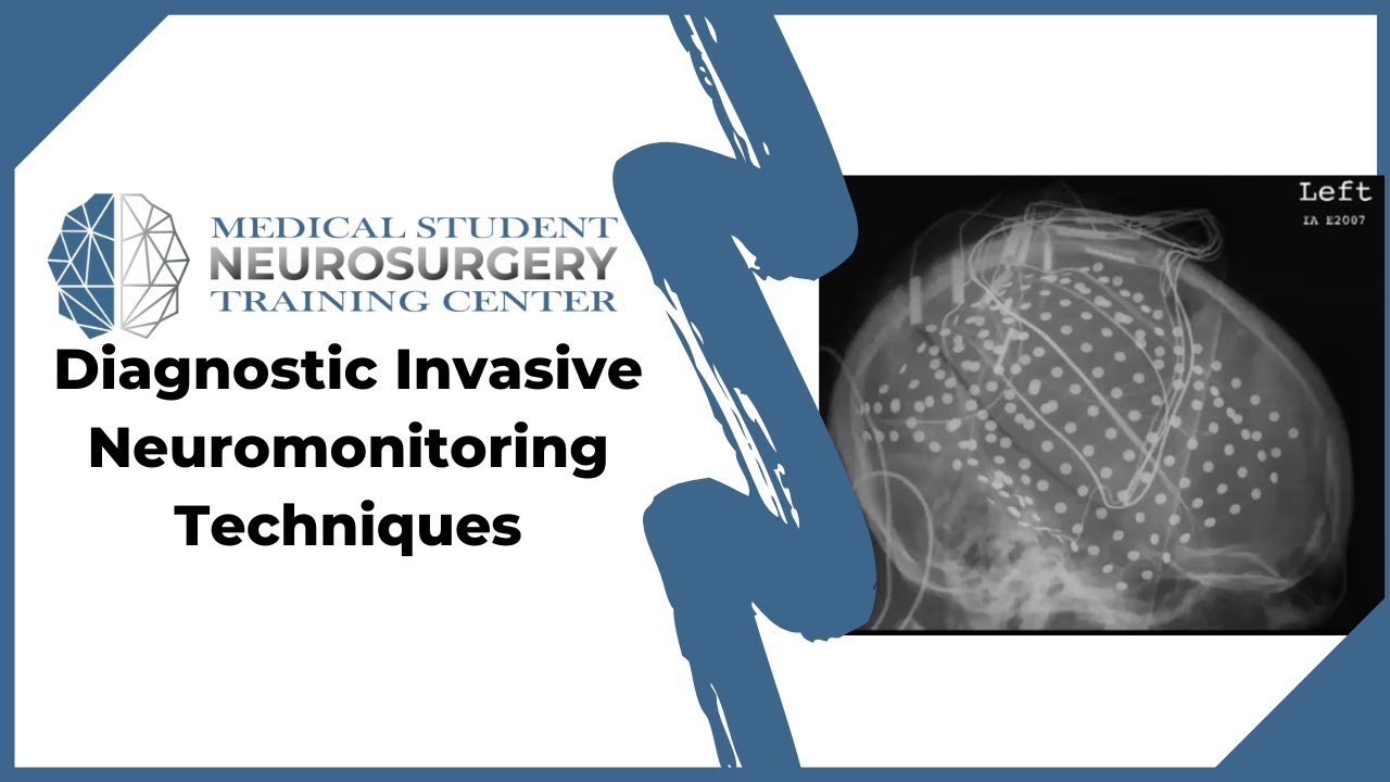 Diagnostic Invasive Neuromonitoring Techniques - YouTube