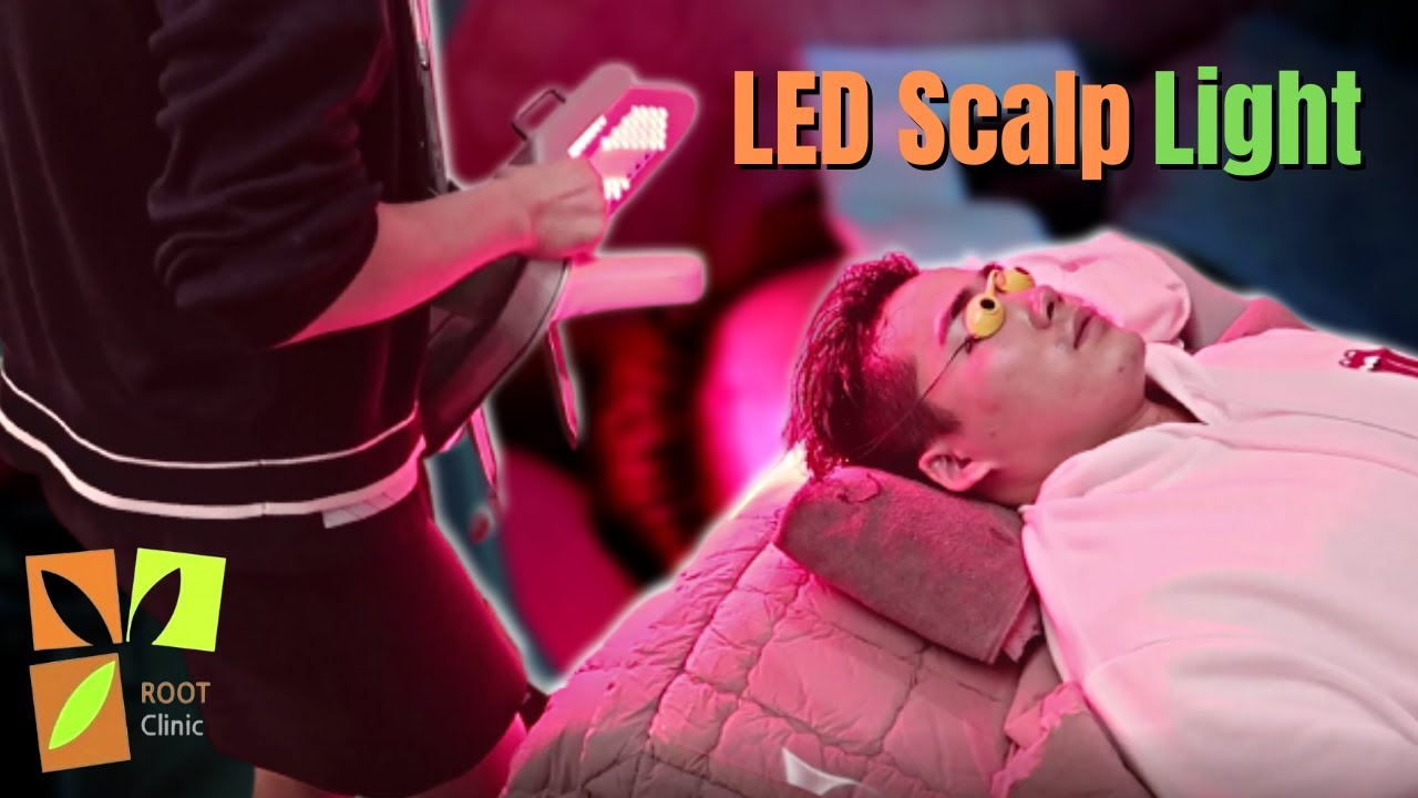 LED Scalp Light l Root Clinic l Hair transplant #RootClinic # ...