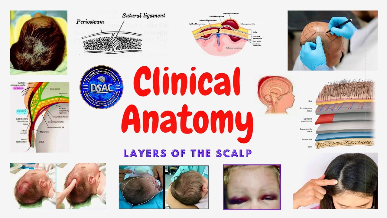 Clinical anatomy of scalp by Dr. SAM #clinicalanatomy #scalp - YouTube