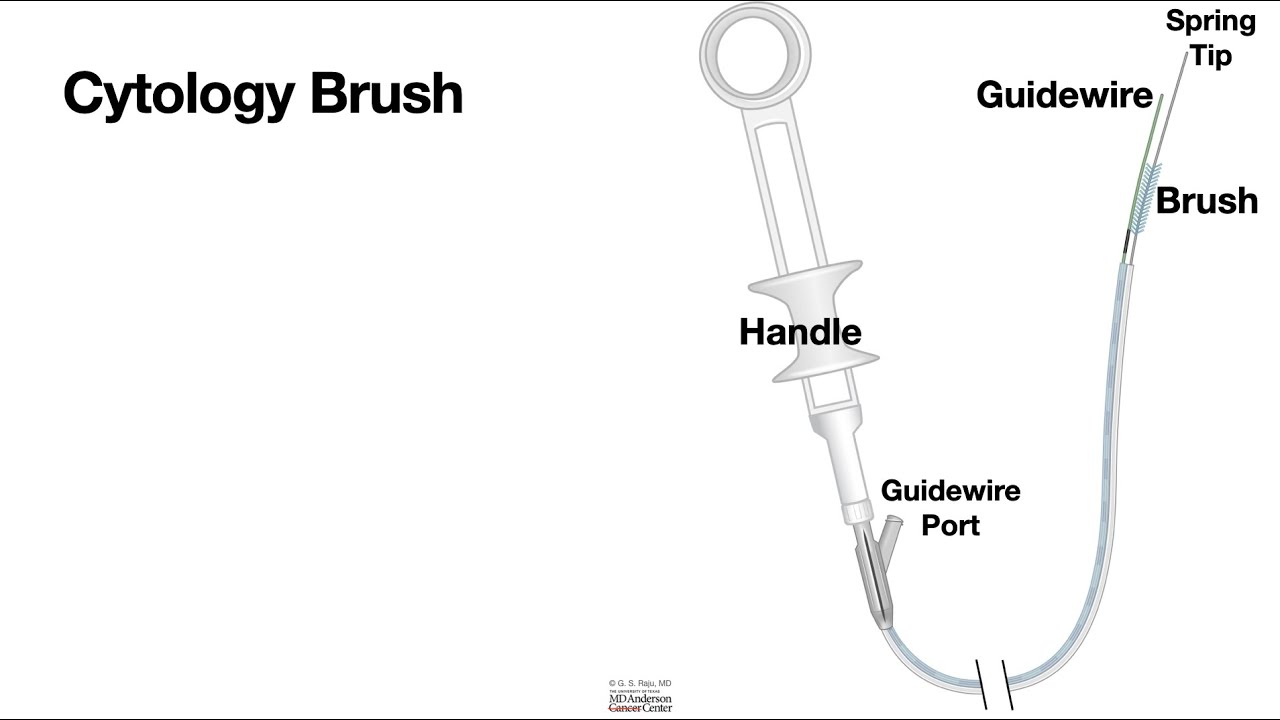 HCC 1474-15 Biliary brush - YouTube