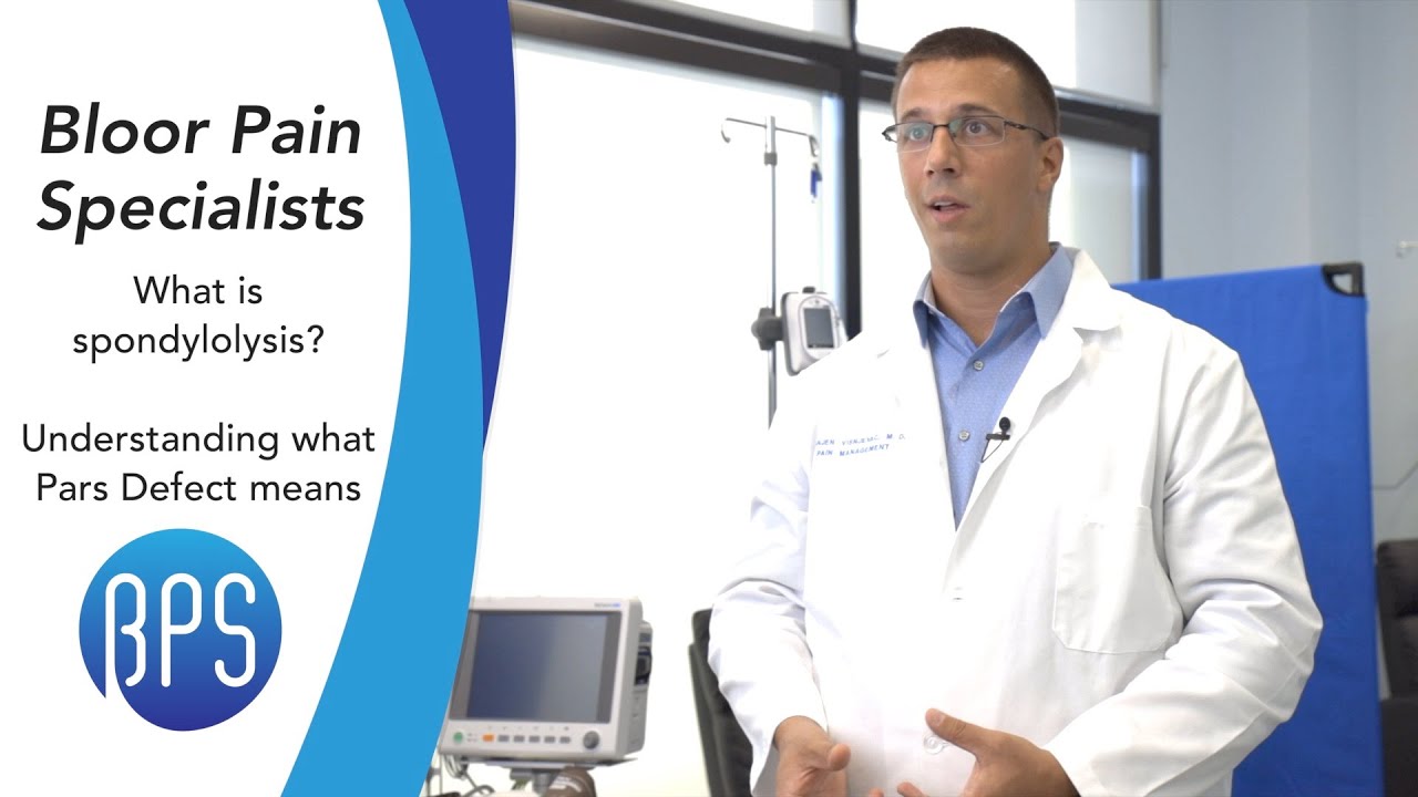 What is Spondylolysis? Understanding What Pars Defect Means - Common ...